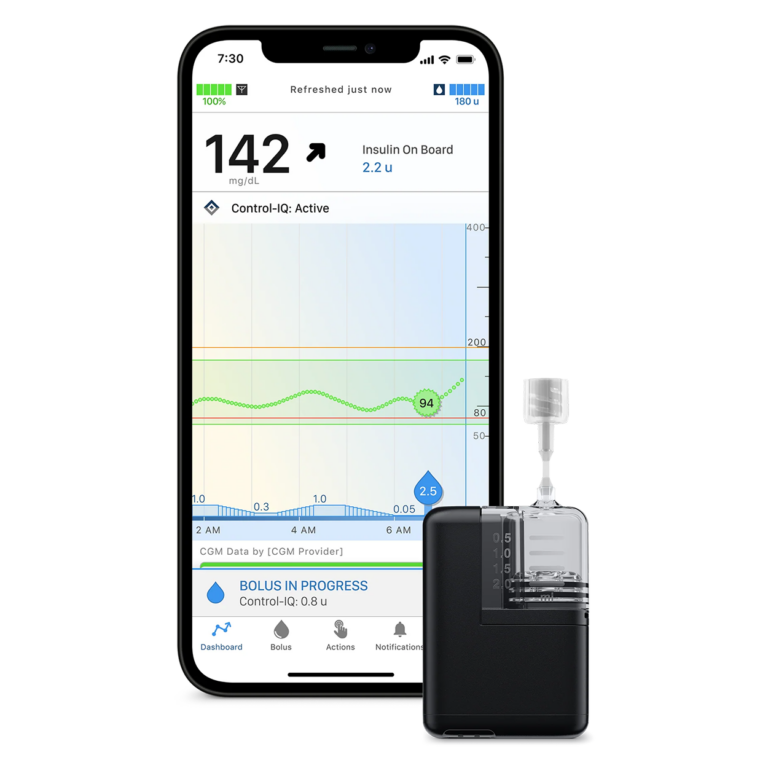 Tandem Insulin Pumps | GEM Edwards Pharmacy